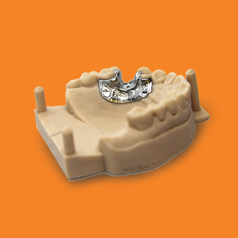 Partial Upper / Lower