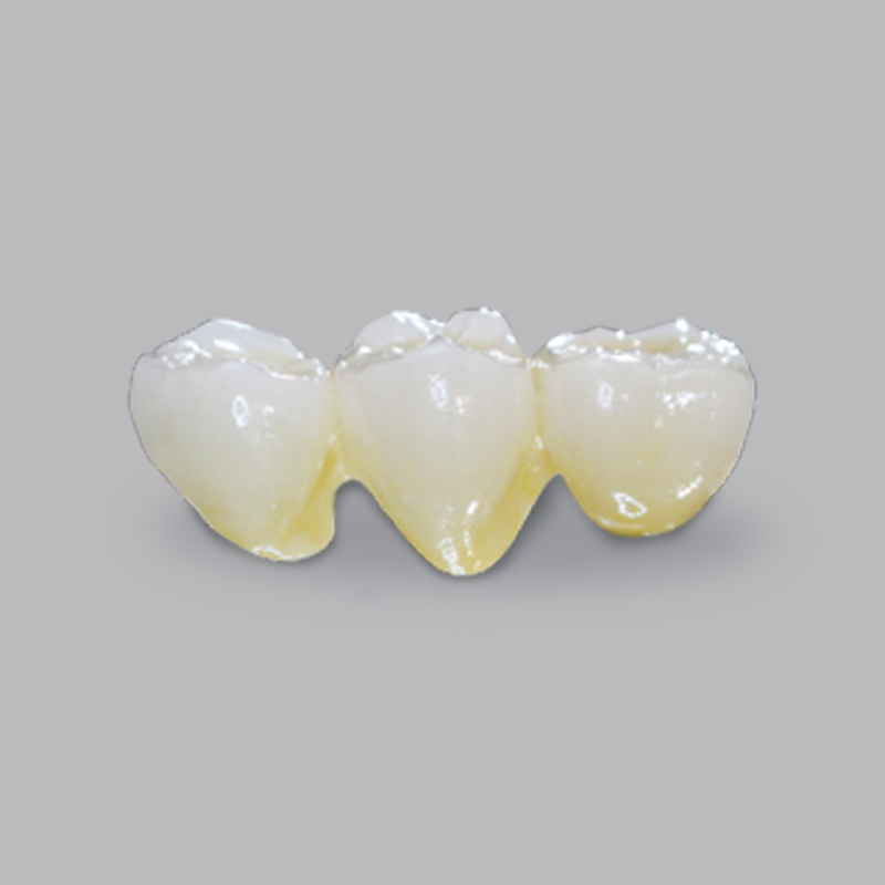 Layered Zirconia